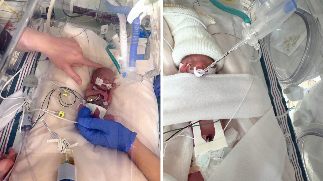 Neonatal-Perinatal Medicine | University of Michigan Medical School